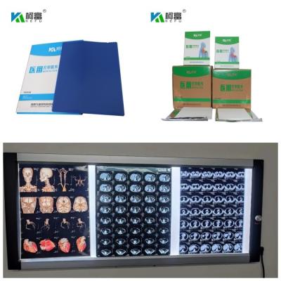 China Inkjet Medical X Ray Film 210 Microns Blue Film Thickness for High Resolution Imaging for sale