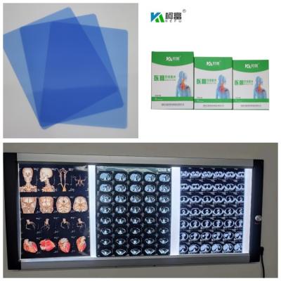 China Medical X Ray Film Inkjet Blue Base 280gsm for DR CT MRI 10x12 11x14 A4 A3 for sale