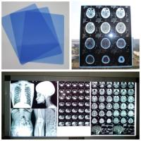 China Medical Inkjet X Ray Film 9600x2400dpi High Resolution 210 Microns Blue for sale