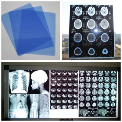 China 210um Inkjet Medical X Ray Film Blue 8x10 for Digital DR CT MRI Cassette Sheets for sale