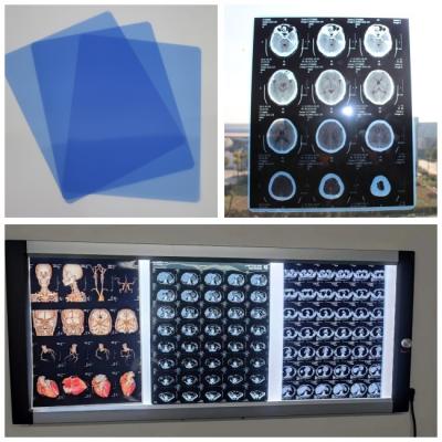 China Blue Base Medical Inkjet Dry Film 210microns A3 13x17 for Digital X Ray Image for sale