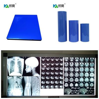 China 280gsm Medical Dry Inkjet X Ray Film Blue Base Digital Color Image Output 14x17inch for sale