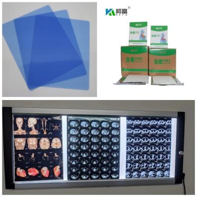 China Digital Medical Inkjet X Ray Film Blue Base 280gsm 14x17inch Waterproof for Imaging for sale