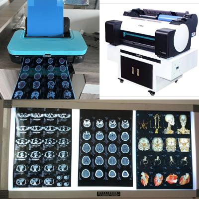 China 210 Microns Blue Inkjet X Ray Film MRI Image Output High Printing Quality Black White for sale