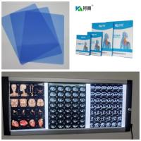 China PET Base Blue Medical Inkjet Film 210 Microns 9600x2400dpi High Resolution for sale