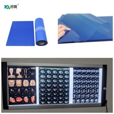 China 210 Micron Inkjet Medical X Ray Film 14x17 for CT DR MRI 3D Image Output Blue Base for sale