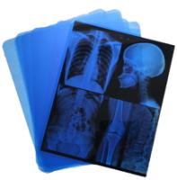 China Kefu L200 Medical X Ray Film 14x17 Low Fog 320dpi Blue Dry Film for CT MRI DR for sale