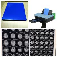 China Glossy Inkjet X Ray Film PET Base 9600x2400dpi Blue White Long Lasting for sale
