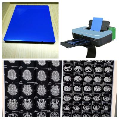 China Glossy Inkjet X Ray Film PET Base 9600x2400dpi Blue White Long Lasting for sale