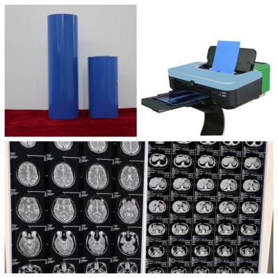 China 210 Microns Blue Base Inkjet Printing X Ray Film 9600x2400dpi A3+ for CR DR for sale