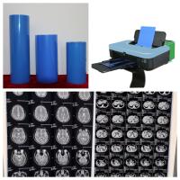 China Kefu Zhengao Inkjet X Ray Film 210 Microns Blue Medical Film for Canon Epson Printers for sale