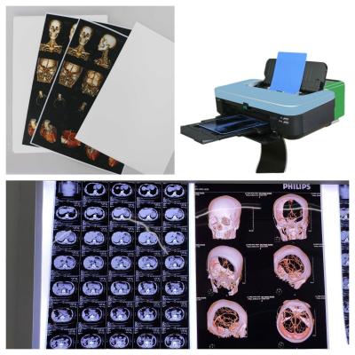 China White Opaque Inkjet X Ray Film 125 Microns for Canon Epson Printers CT MRI for sale