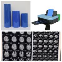 China PET Base Blue Medical Inkjet Film 210 Microns 9600x2400dpi High Resolution for sale