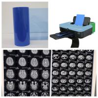 China Kefu Zhengao MFIBW Inkjet X Ray Film 210 Microns for Medical Imaging 8x10 to 14x17 for sale