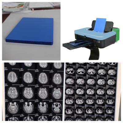 China Inkjet X Ray Film 17inch Roll 210 Microns High Resolution for Medical Imaging for sale
