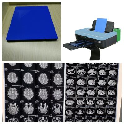 China 210 Microns Blue Inkjet X Ray Film Compatible With Canon Epson Printers A4 A3 for sale