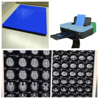 China Inkjet X-Ray Film 210 Micron for Canon Epson Printers - ISO 13485 CE Certified Medical Imaging Film for sale