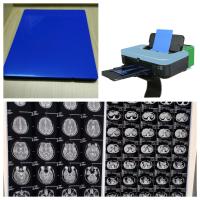 China Medical Inkjet X Ray Film 9600x2400dpi High Resolution 210 Microns Blue for sale