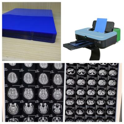 China 210 Microns PET Inkjet X Ray Film 14inch High Image Stability Medical for sale