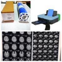 China Kefu Zhengao Inkjet X Ray Film 125-180 Micron for Canon Epson Printers ISO CE for sale