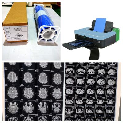 China Kefu Zhengao Inkjet X Ray Film 125-180 Micron for Canon Epson Printers ISO CE for sale