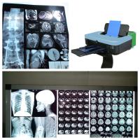 China Kefu Zhengao MFIBW Inkjet X-Ray Film 125-180 Micron Thickness for Canon Epson Printers for sale