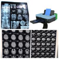 China 10inch Inkjet Color X Ray Film for Medical Imaging 210 Microns Blue Transparent for sale