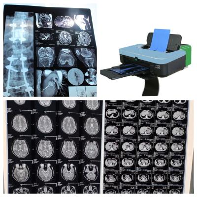 China 10inch Inkjet Color X Ray Film for Medical Imaging 210 Microns Blue Transparent for sale