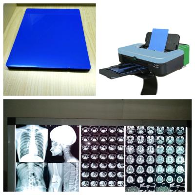 China Inkjet X Ray Film Sheets 8x10 10x12 14x17 A4 A3 PET Base for Canon Epson Printers for sale