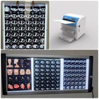 China Medical Dry X-Ray Film 11x14 14x17 with 204μm PET Base and ≤20% Haze for Thermal Printers for sale