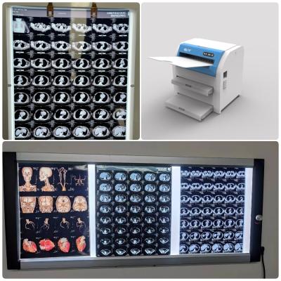 China Medical Dry X-Ray Film 11x14 14x17 with 204μm PET Base and ≤20% Haze for Thermal Printers for sale
