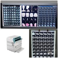 China Kefu L200 Medical X Ray Film 14x17 Low Fog 320dpi Blue Dry Film for CT MRI DR for sale