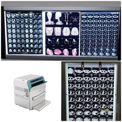 China Kefu L200 Medical X Ray Film 14x17 Low Fog 320dpi Blue Dry Film for CT MRI DR for sale