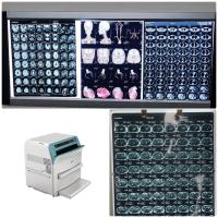China Medical X Ray Blue Film 200±5μM High Sharpness Low Fog Level 8x10 to 14x17 for sale