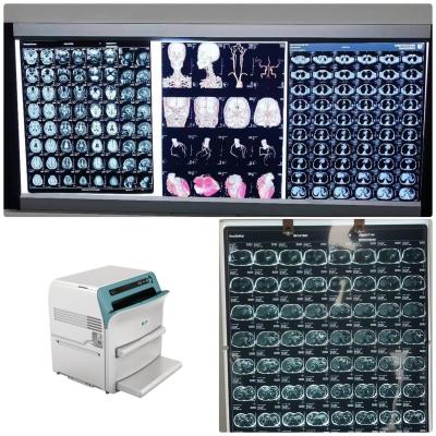 China Medical X Ray Blue Film 200±5μM High Sharpness Low Fog Level 8x10 to 14x17 for sale