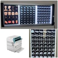 China Medical X-Ray Dry Film 10x12 Inch 205μm Thickness for Fuji DR CT MRI DSA Printers for sale
