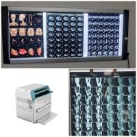 China Class I Medical X-Ray Radiology Dry Film 14x17 Inch Blue Thermal Film for Hospital Imaging Systems for sale
