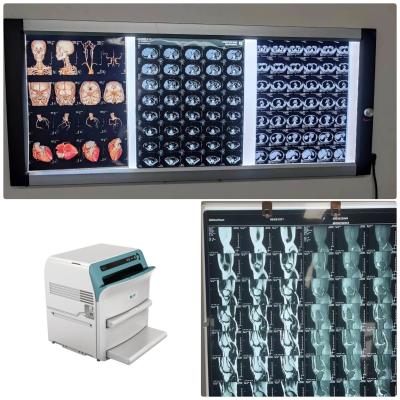 China Class I Medical X-Ray Radiology Dry Film 14x17 Inch Blue Thermal Film for Hospital Imaging Systems for sale