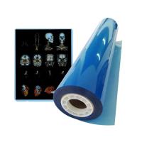 China A4 Medical Blue Xray Dry Clear Inkjet Waterproof Film 210 Micron 280 Gsm For Printer for sale
