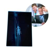 China Blue Medical X Ray Film 10x12 inch 210 Micron PET Inkjet Film for CT MRI DR Imaging for sale