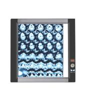 China Blue Medical X Ray Film 10x12 inch for Inkjet Printer 210 Microns for sale