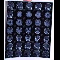 China Blue Medical X Ray Film 10x12 inch for Inkjet Printer 210 Microns for sale