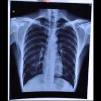 China Medical X-ray Dry Inkjet Film 210 Micron 280gsm for CR DR CT MRI Output for sale