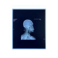 China Medical X-ray Dry Inkjet Film 210 Micron 280gsm for CR DR CT MRI Output for sale