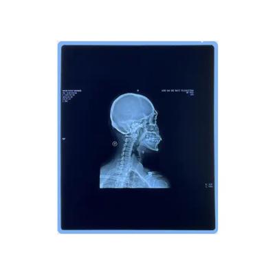 China Medical X-ray Dry Inkjet Film 210 Micron 280gsm for CR DR CT MRI Output for sale