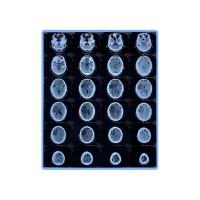 China Blue Medical X Ray Film 10x12 inch for Inkjet Printer 210 Microns for sale