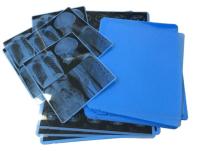 China Blue Medical X Ray Inkjet Film 10x12 Inch 210 Micron for Clear DR CT MRI Imaging for sale