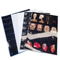 China Medical X Ray Film FUJI DIHT 14x17in Laser Dry Imaging Film 100 Sheets per Box for sale
