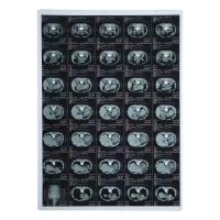 China Medical Dry Laser X Ray Imaging Film 8x10 10x12 11x14 13x17 Inches 100 Sheets Box for sale