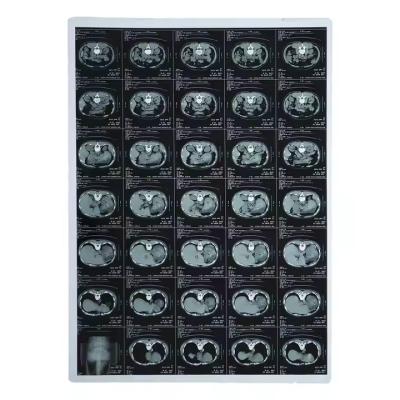 China Medical Dry Laser X Ray Imaging Film 8x10 10x12 11x14 13x17 Inches 100 Sheets Box for sale